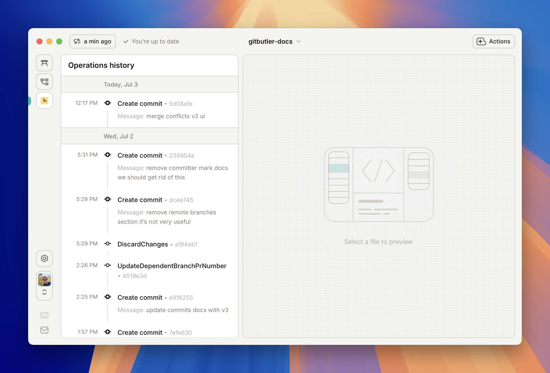 Operations History | GitButler Docs